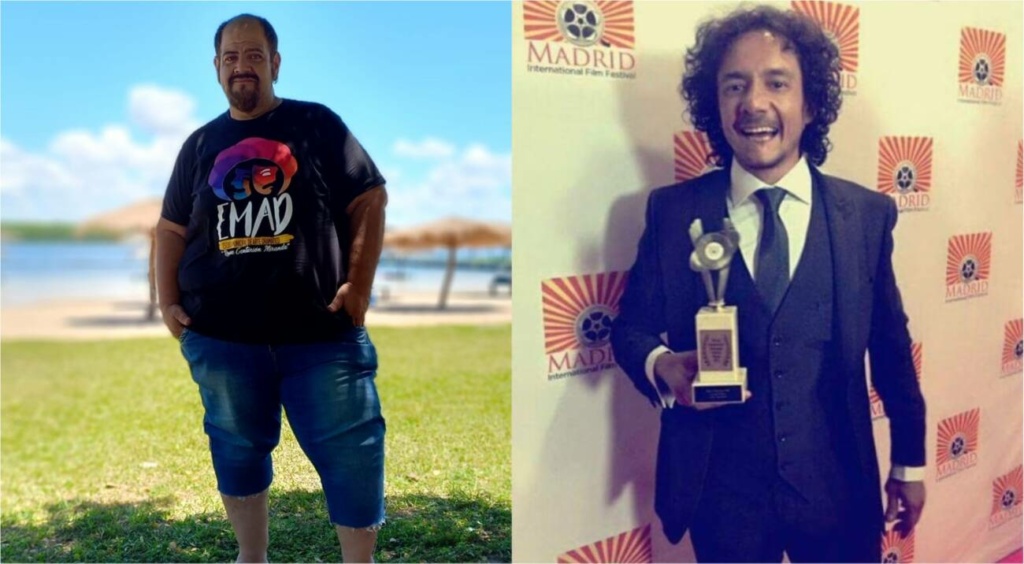 Contó Que El Actor Javier Enciso Quemó Bulbo